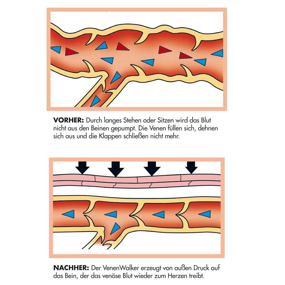 Venen-Walker „Pro“ | EUROtops.be